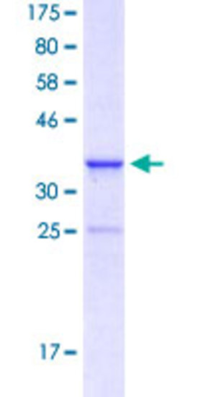 Human NANOG Partial ORF (NP_079141.2, 98 a.a. - 195 a.a.) Recombinant ...